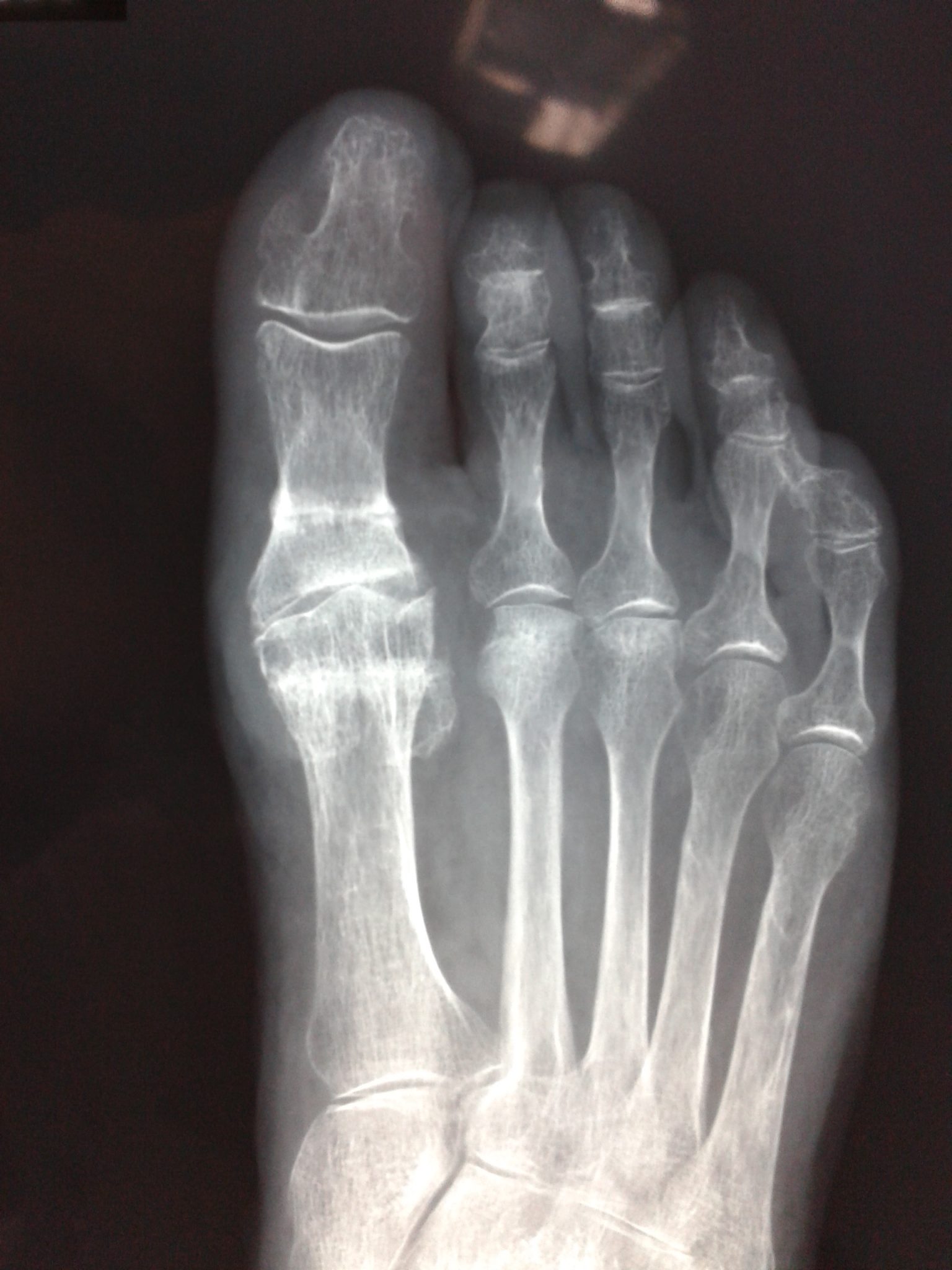 Servicio de radiografía digital - Podólogo Lanzarote - Podóloga ...